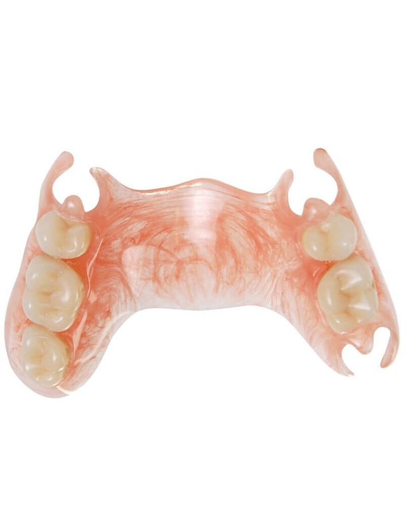 Removable partial prosthesis acrylic